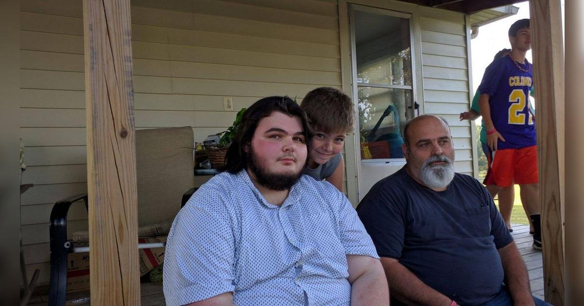 Estados Unidos: Dylan Wall perdió 100 kilos tras cambiar estilo de vida ...