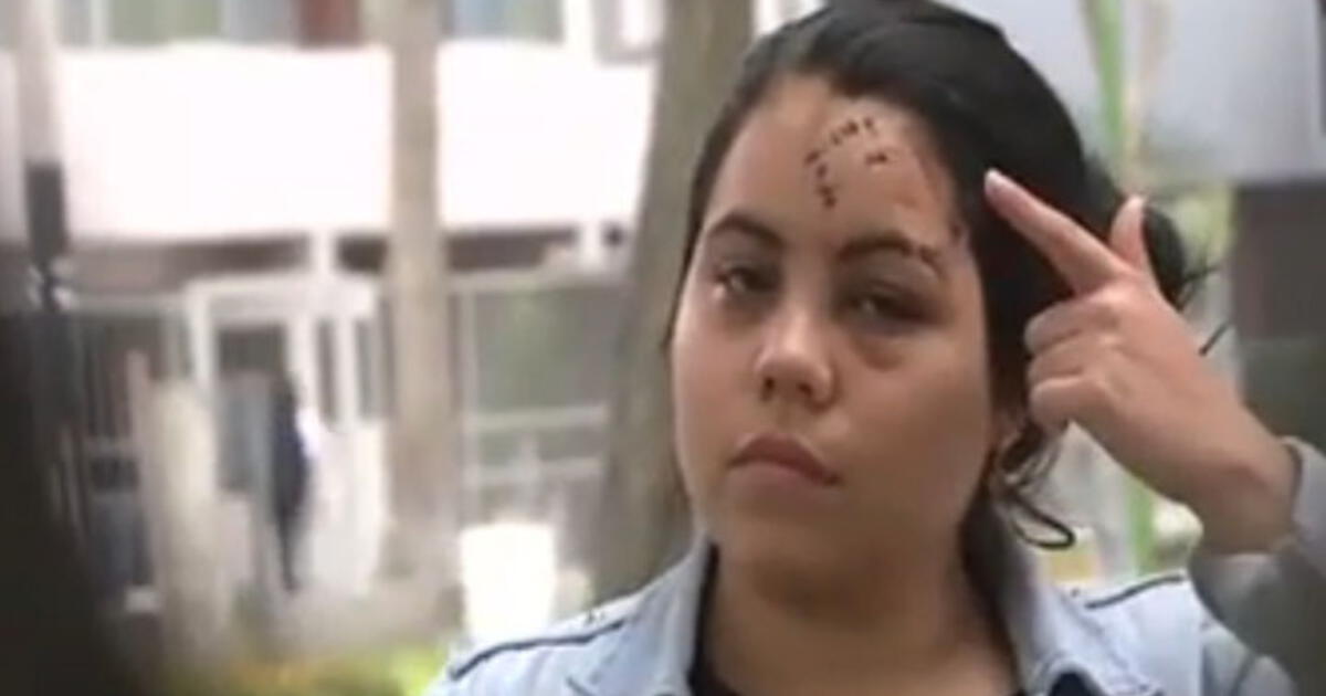 Chorrillos Mujer Quedó Desfigurada Tras Ser Atacada Por Su Examiga [video]