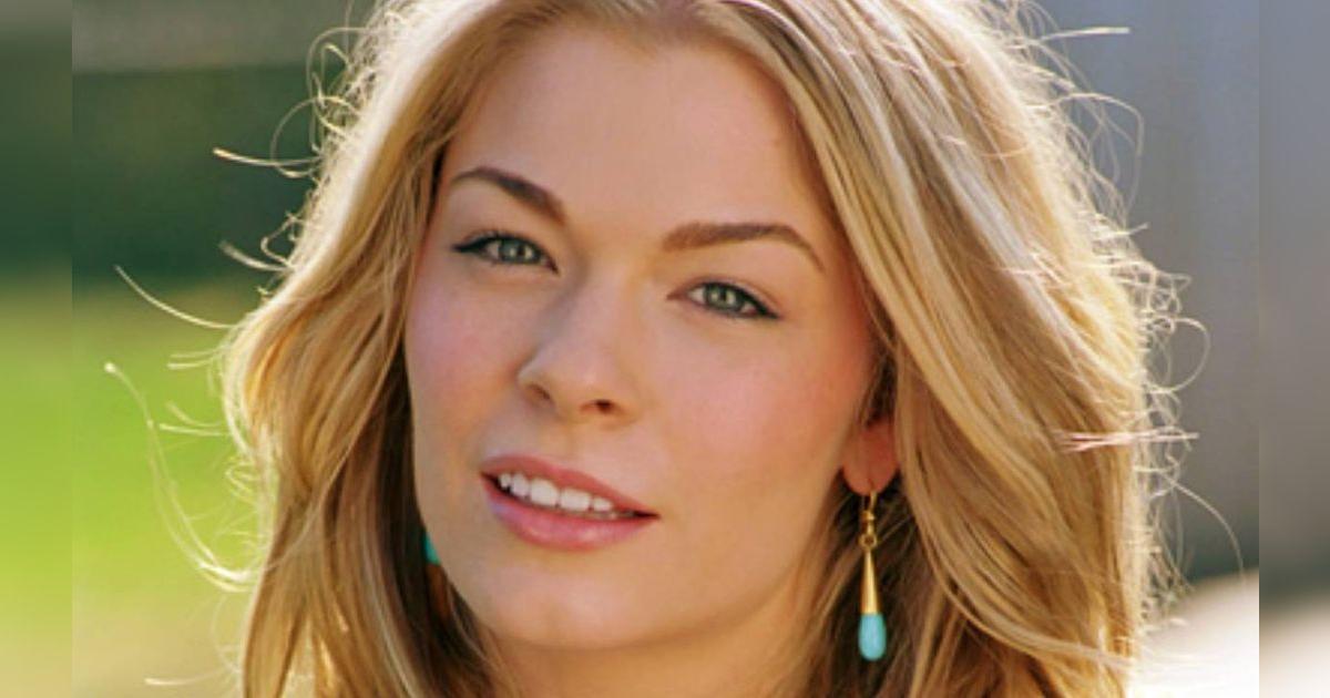 LeAnn Rimes comparte fotografías de su psoriasis para concientizar ...