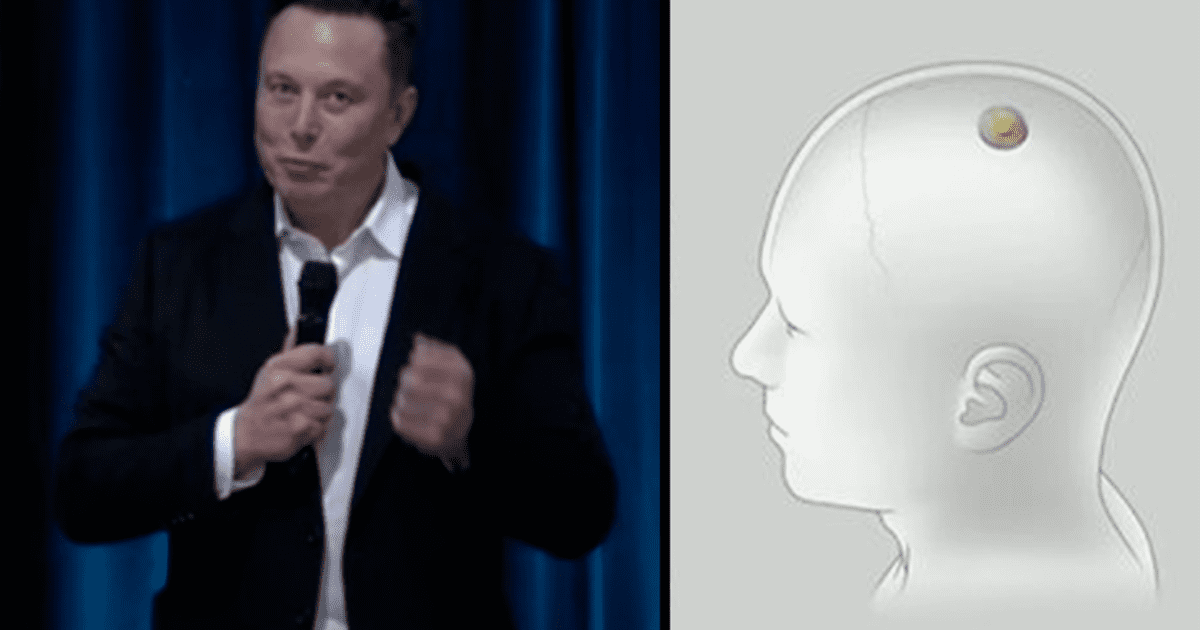 Multimillonario Elon Musk Revela último Avance De Neuralink Un Chip