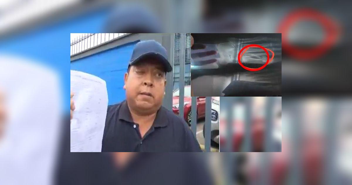 Negligencia médica | Hombre tiene vidrio incrustado en el pie desde ...