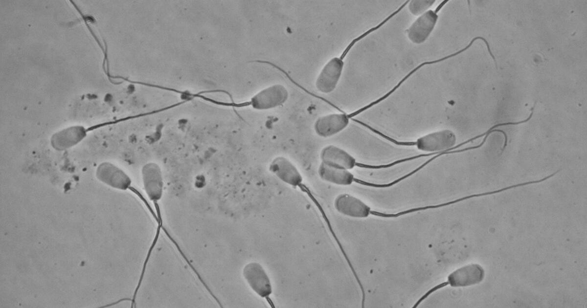 ¿por Qué La Cantidad Y La Calidad De Los Espermatozoides Está