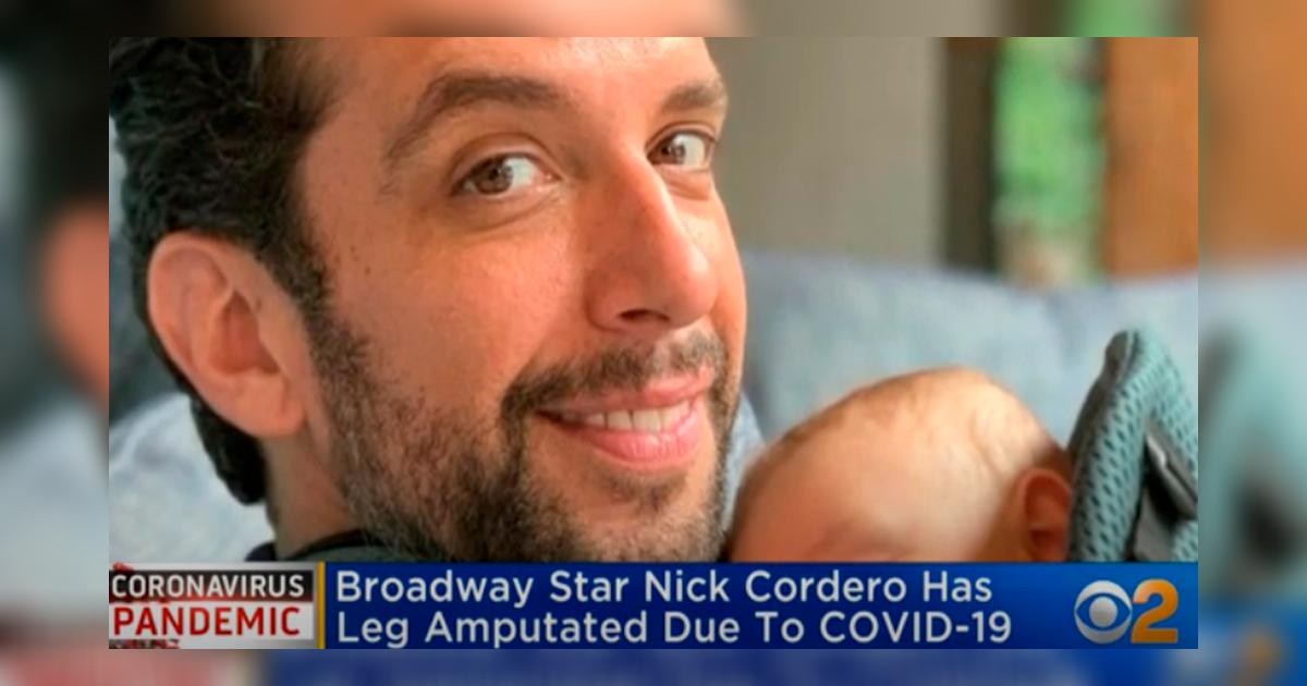 Nick Cordero, actor de Brodway, sufre la amputación de una pierna por ...