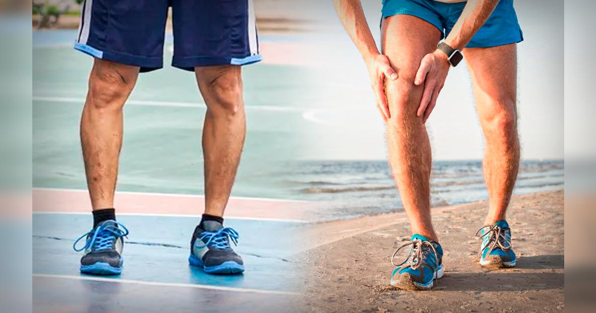 ¿Por qué algunas personas tiene las piernas arqueadas? | Salud | La ...