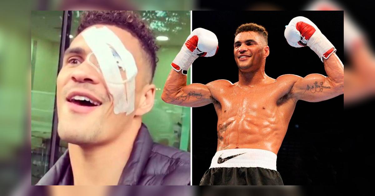 Twitter | Inglaterra: Boxeador fue operado seis veces del ojo y cuenta ...