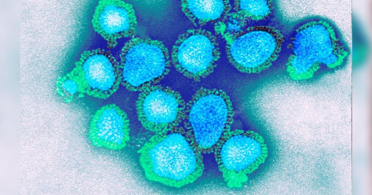 Dos cepas de la gripe podrían haberse extinguido gracias a la COVID-19 ...