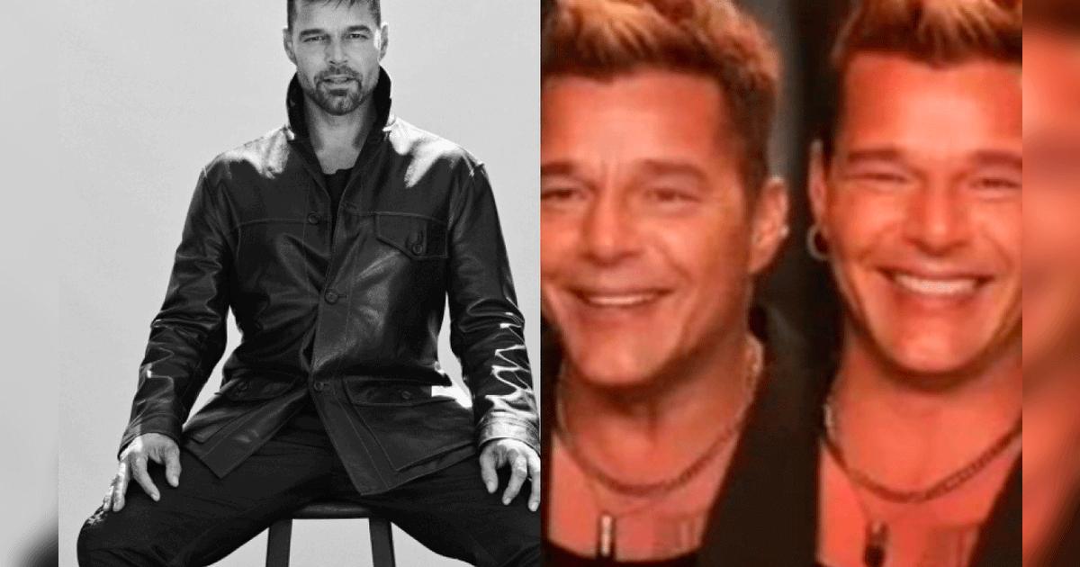 Ricky Martin: equipo de prensa aclara que sufrió reacción alérgica en ...