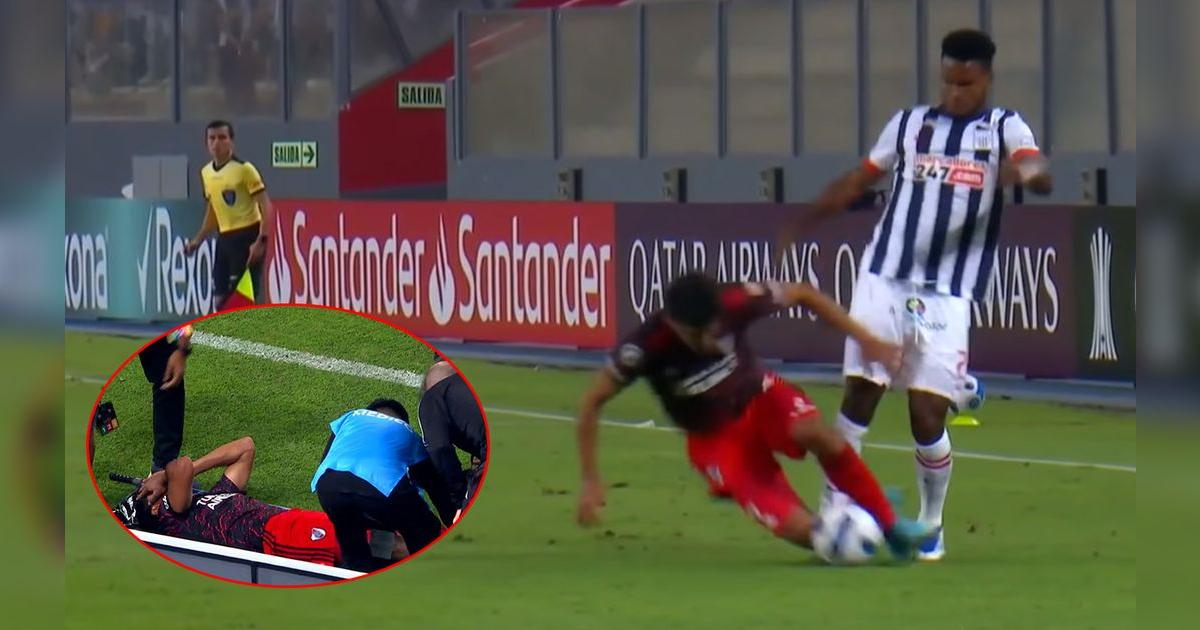 Robert Rojas: River Plate confirmó fractura de tibia y peroné del ...