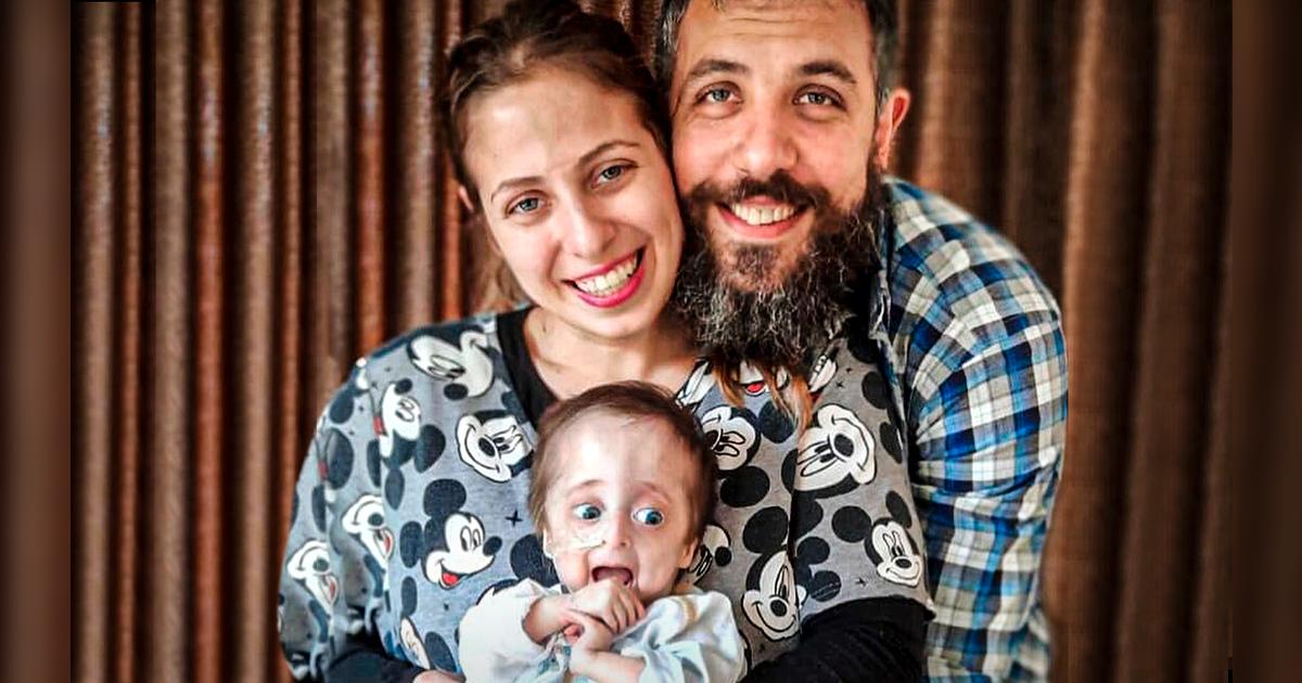 La sorprendente historia de Vito, el ‘Benjamin Button’ de la vida real ...