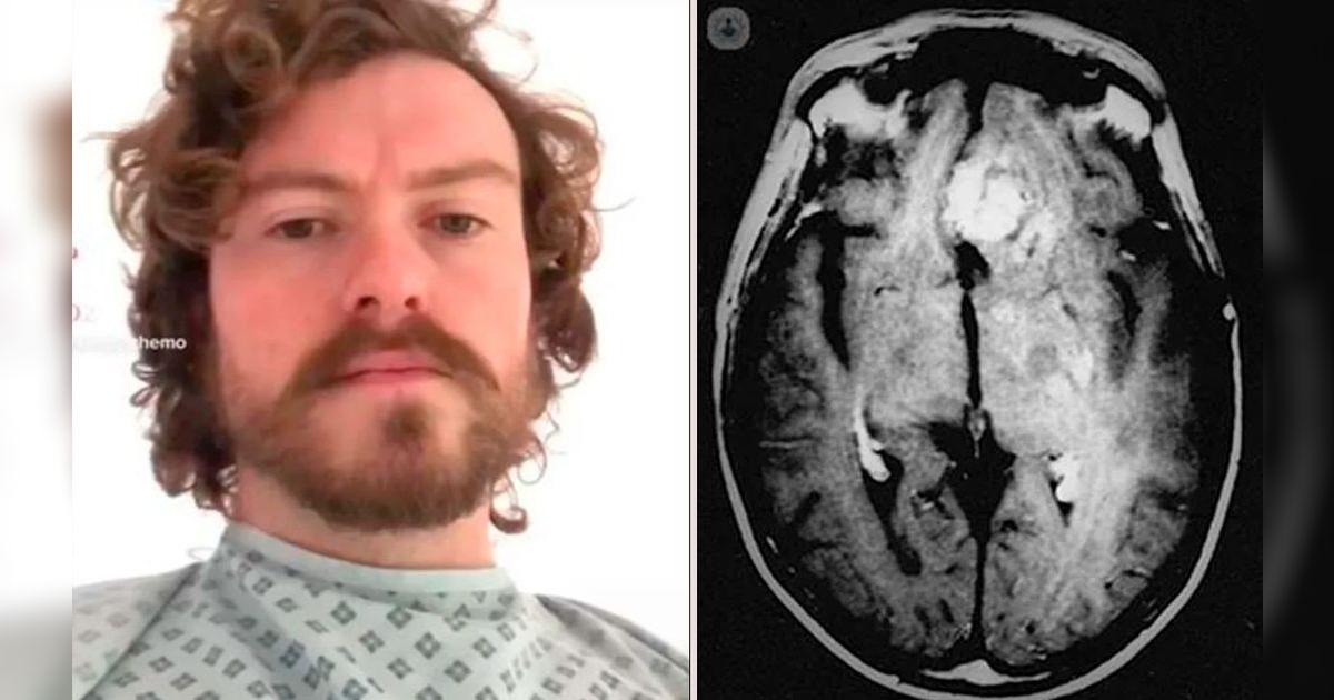 Viral | Participa de un ensayo médico para ganar dinero extra y le ...