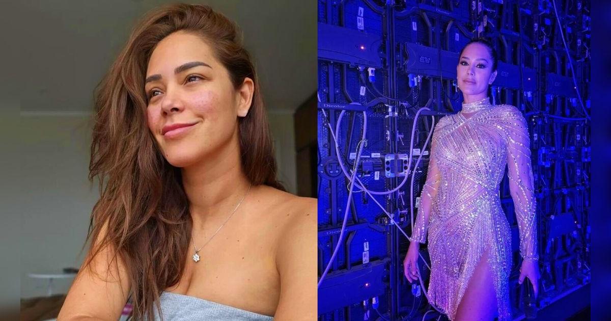 Karen Schwarz: qué es la rosácea, enfermedad que padece la modelo | instagram | cuidado de la ...