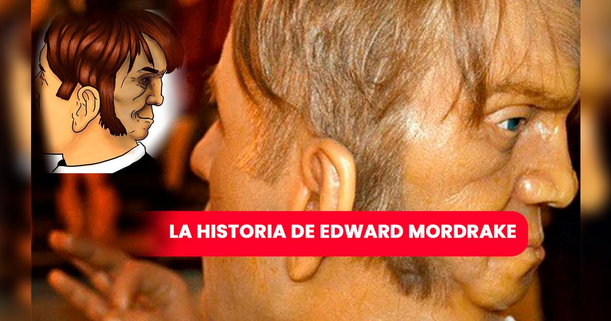 El caso de Edward Mordrake, el hombre de 2 caras: mito o malformación | Duplicación craneofacial ...