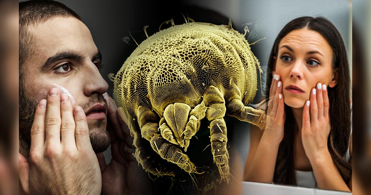 Ácaros en la piel: Cómo son los ácaros que viven en nuestra cara | qué ...