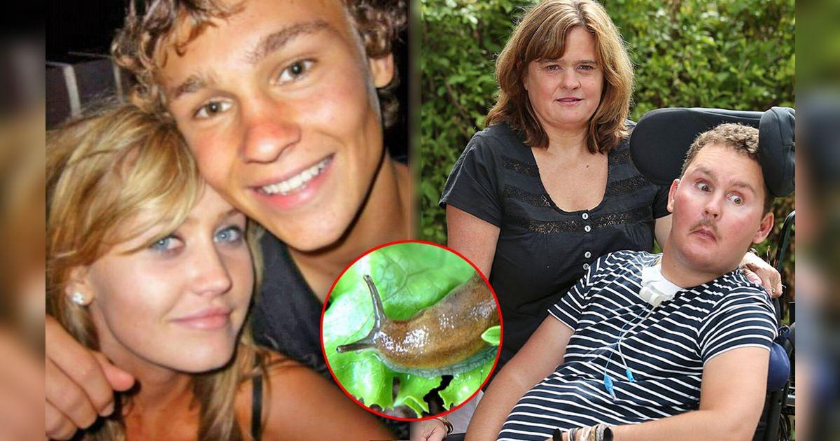 Comió una babosa por un reto entre amigos, quedó tetrapléjico por años ...