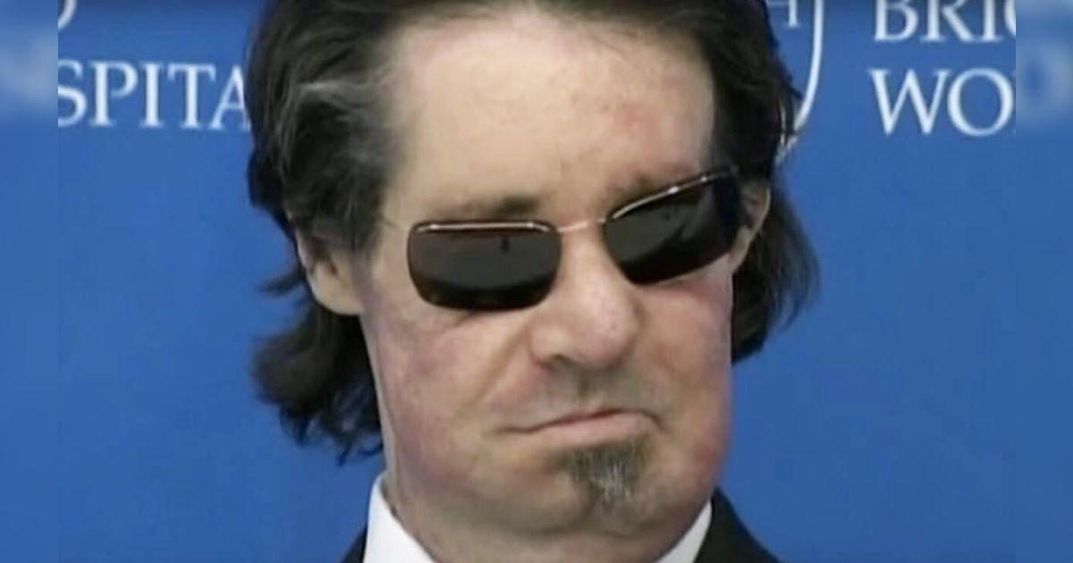 Viral | Dallas Wiens, la primera persona en EE. UU. que recibió un ...