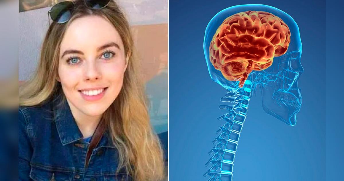 El curioso caso de Emily Balfour: rara condición hace que su cerebro se ...