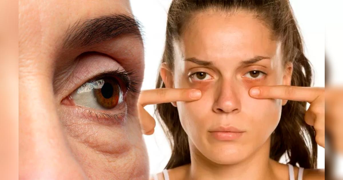 El pepino: la poderosa planta que reduce la flacidez en la piel, ojeras ...