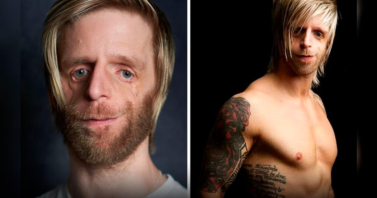 La historia de Jono Lancaster: fue abandonado al nacer por una ...