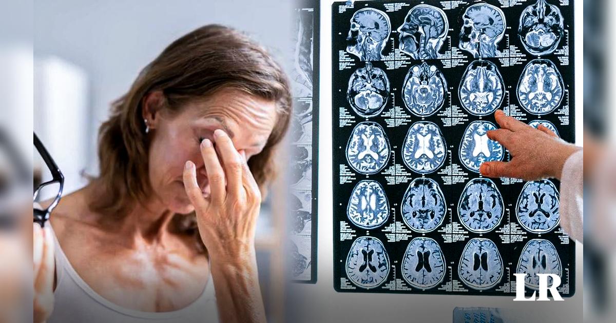 Mujer creyó que tenía orzuelo y le diagnostican que era tumor cerebral ...