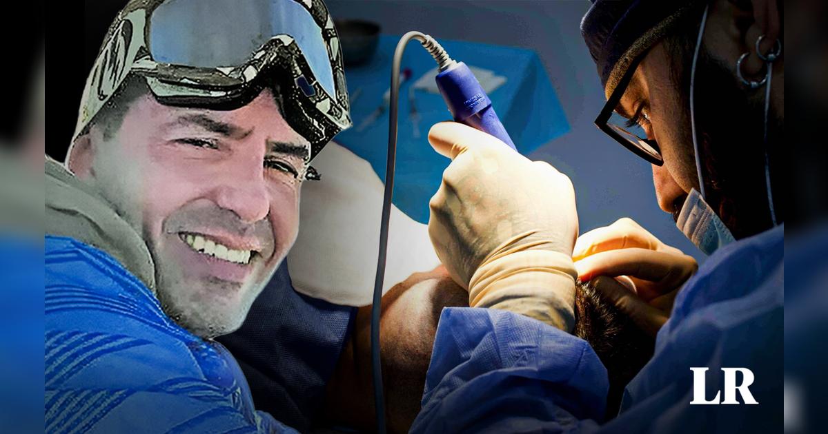 España: la trágica historia de un hombre que se hizo implante capilar y ...