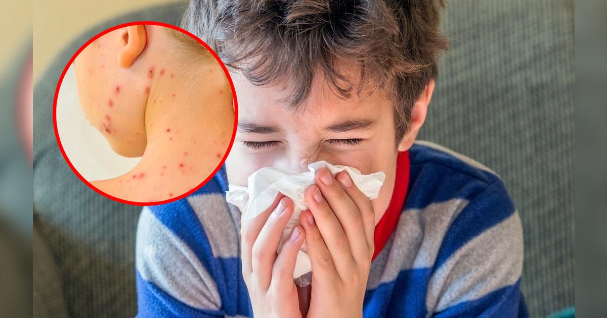 Perú en alerta por 'bacteria asesina' que alarmó a Chile y Japón: ¿Cómo ...