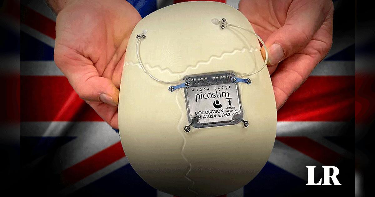 Instalan en el cráneo de niño británico el primer dispositivo mundial ...