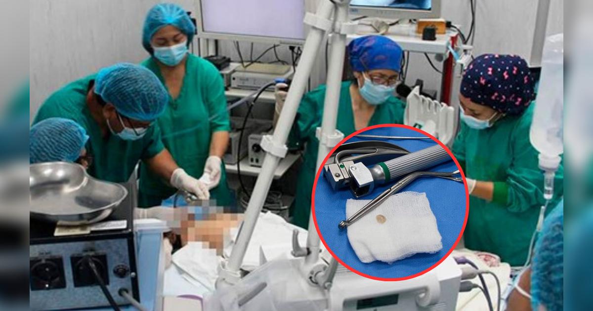 Niño de 1 año se salva de morir tras atorarse con frijol: tuvo que ...