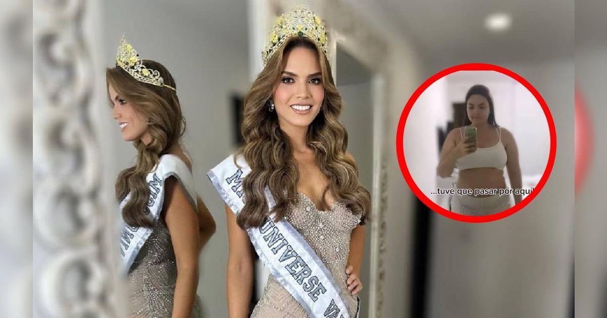 La reina de belleza que batalló contra el sobrepeso y busca darle la corona de Miss Universo a ...