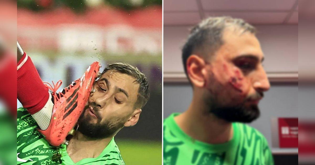 Gianluigi Donnarumma sufrió salvaje patada en el rostro durante el PSG ...