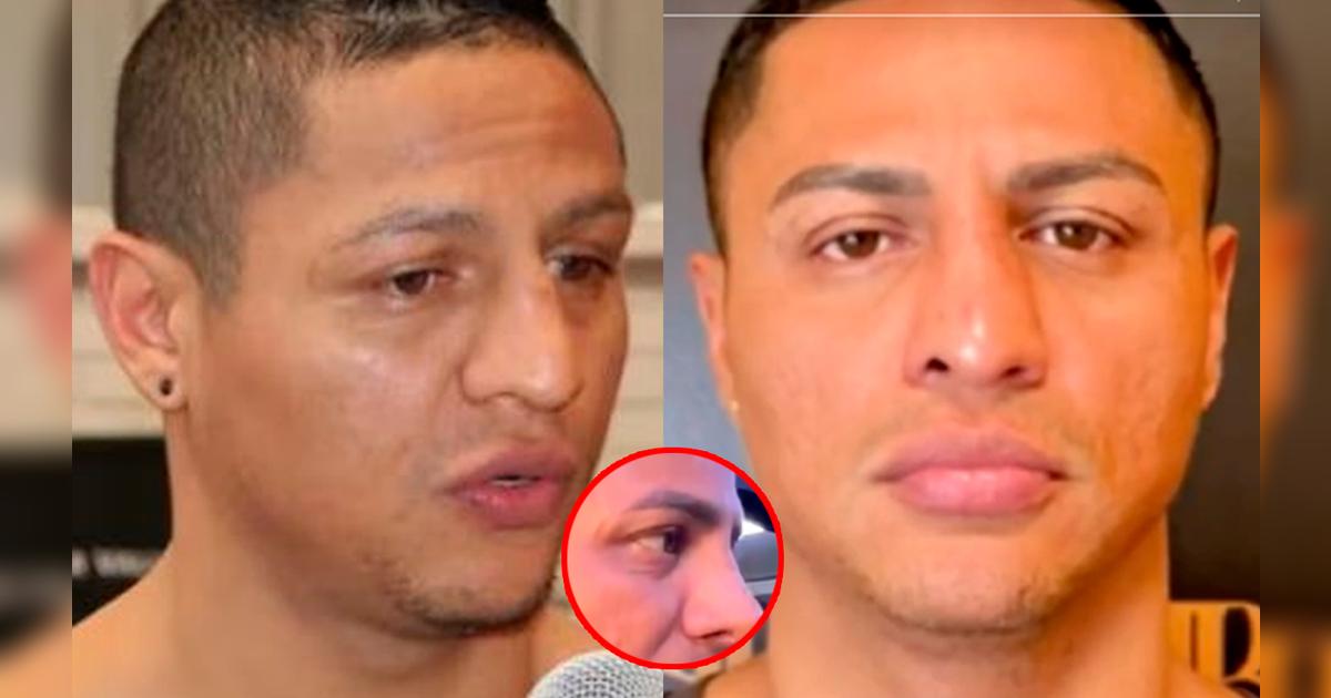 Jonathan Maicelo impacta a usuarios con radical cambio tras operación a ...