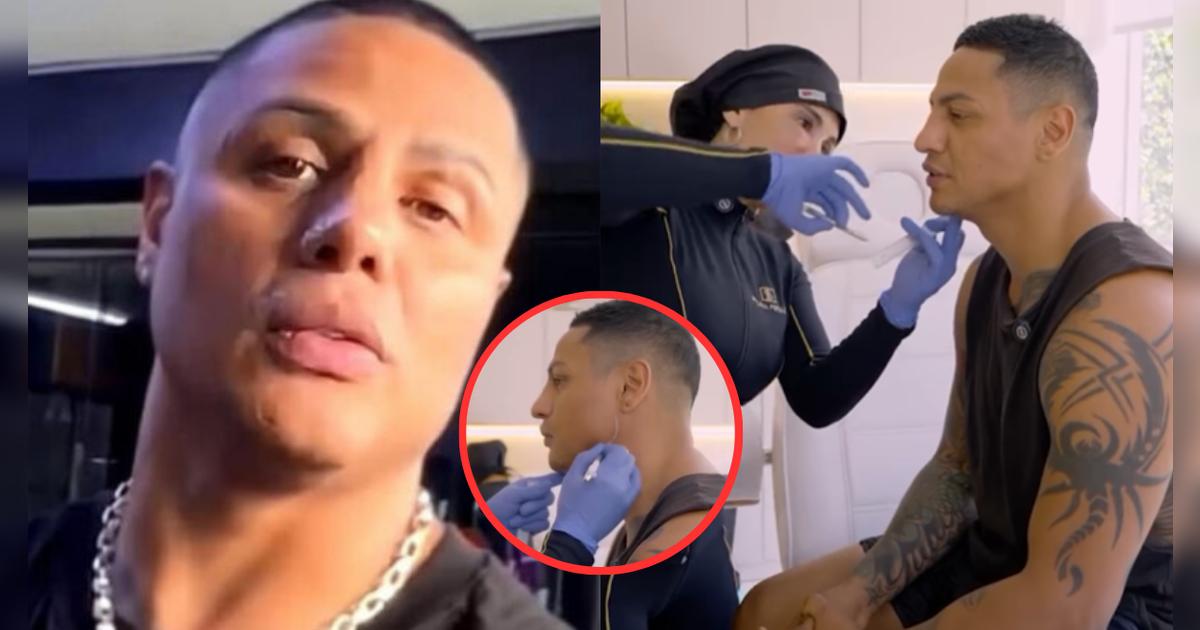 Jonathan Maicelo se habría sometido a otro retoque estético tras su ...