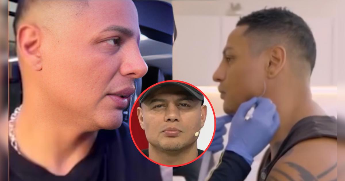 Jonathan Maicelo niega hacerse nuevos retoques estéticos, pero la Dra ...