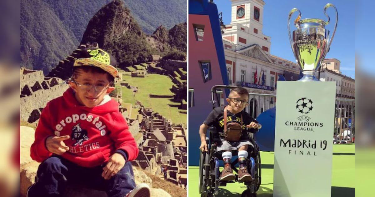 La inspiradora historia de Babidi: nació con una esperanza de vida de ...