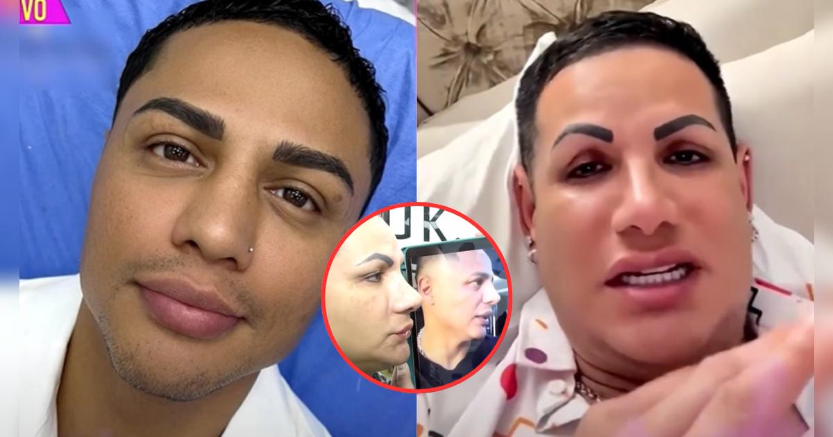 Jonathan Maicelo se somete a nuevos retoques en su rostro y sorprende a ...