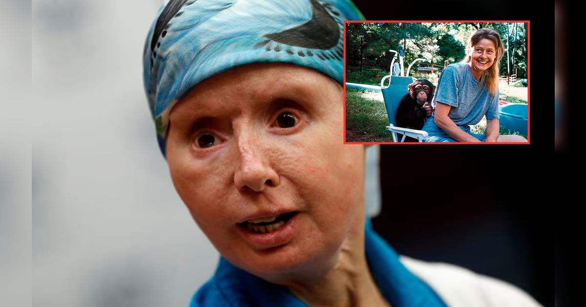 Ataque de chimpancé: El impactante caso de Charla Nash en EE.UU - Notiulti