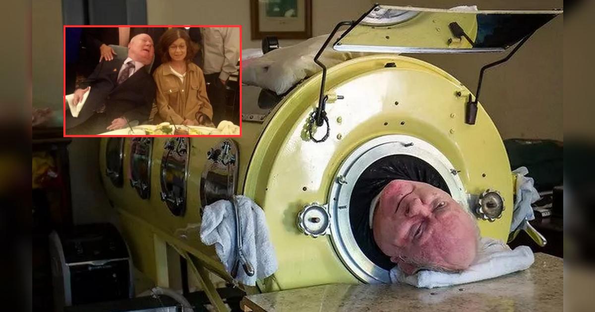 El increíble caso de Paul Alexander, el hombre que vivió con un pulmón ...