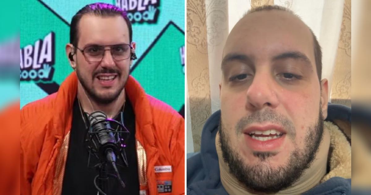 Youtuber Furrey regresa a 'Habla Good' tras casi 2 meses del accidente ...