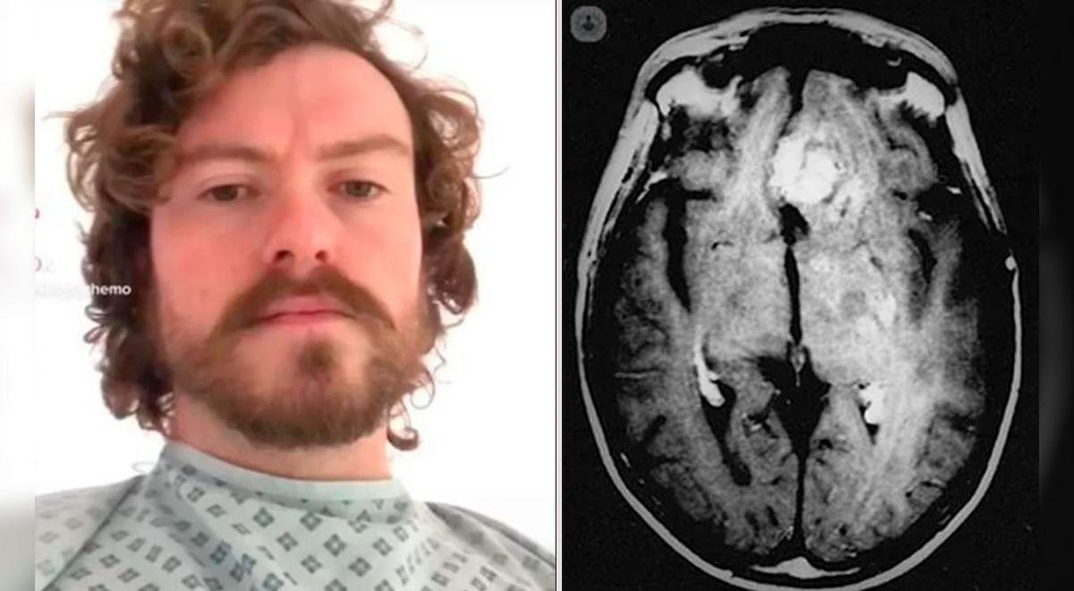 Viral | Participa de un ensayo médico para ganar dinero extra y le ...