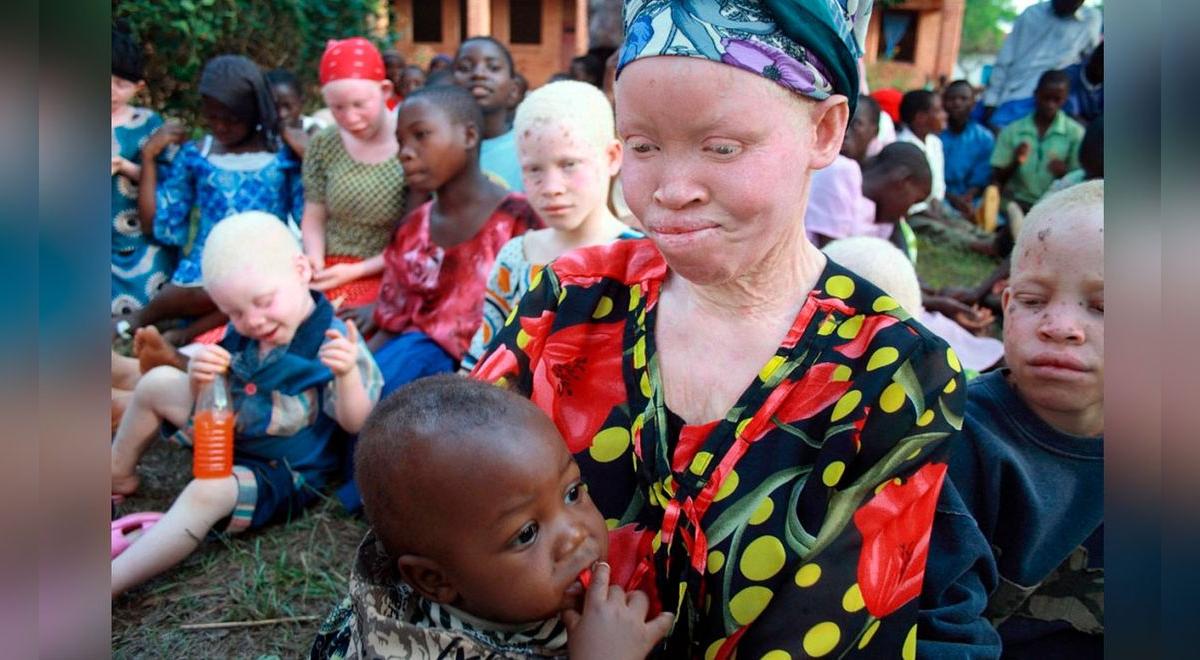 Vivir con miedo: niños y adultos albinos en África son asesinados para ...