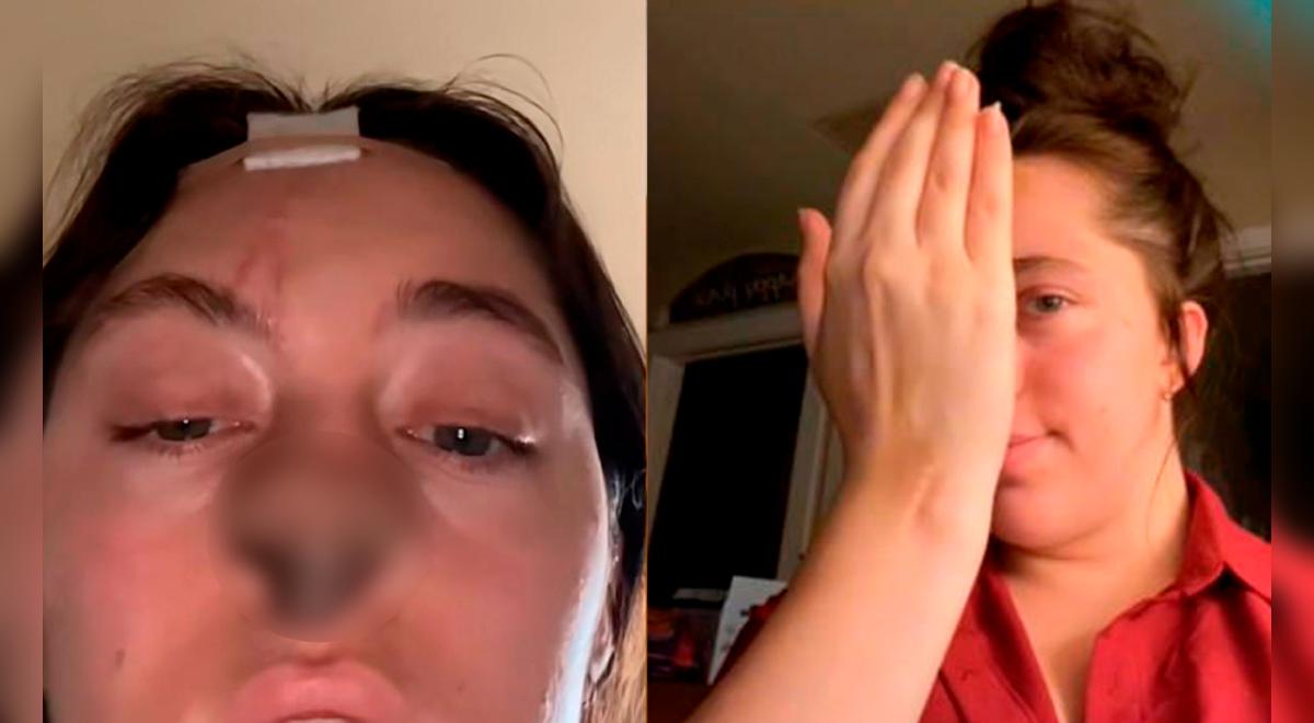 Viral | Trinity Rowles | Perro le desfiguró el rostro, recibió injerto ...