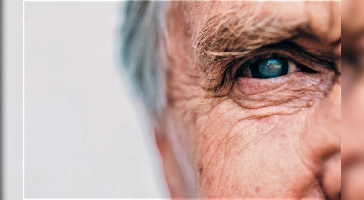 Oftalmología. Cuidado con la catarata, afecta tu visión | Salud | La ...