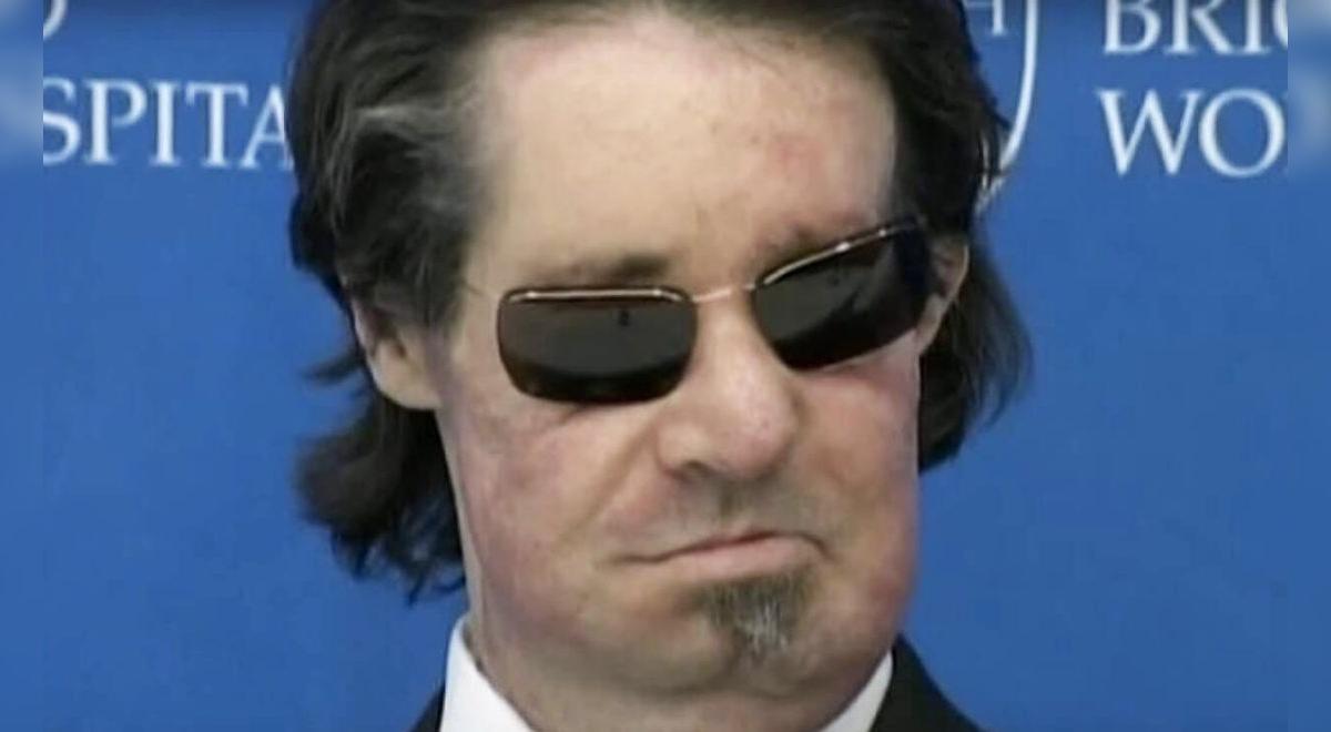 Viral | Dallas Wiens, la primera persona en EE. UU. que recibió un ...