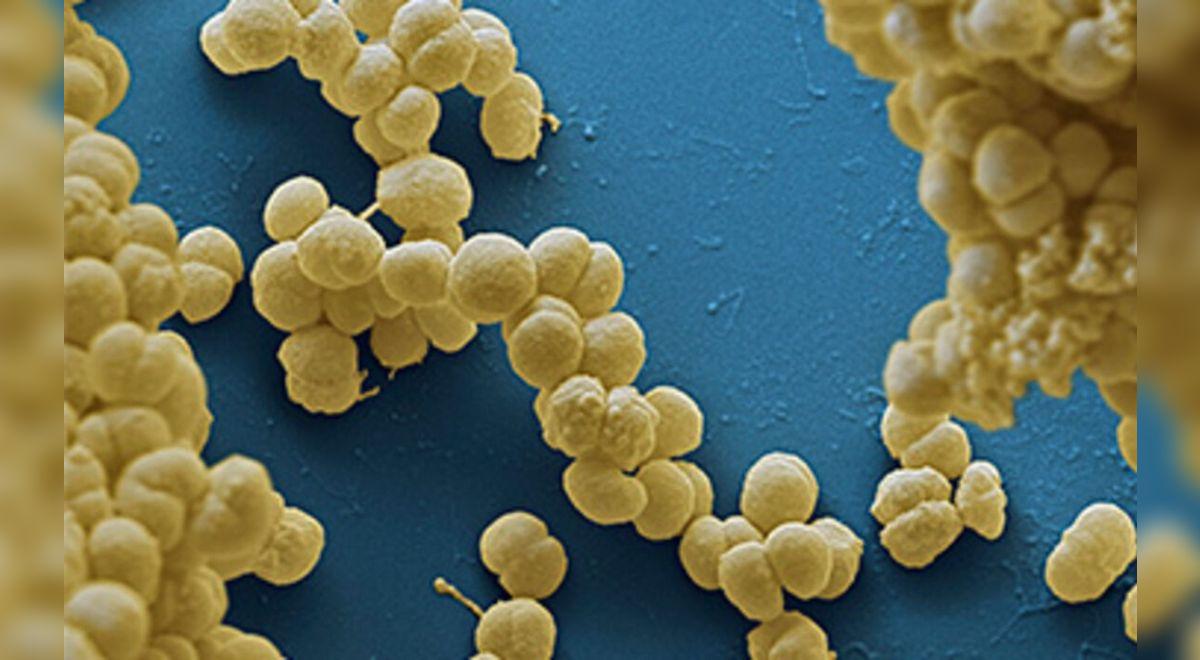 ¿Qué es el meningococo cepa B, cómo se contagia, síntomas y en qué ...