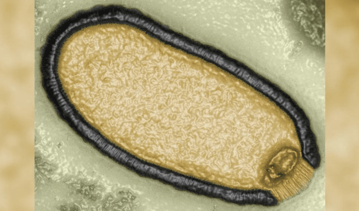 Virus 'zombi': científicos reviven extraño patógeno que estuvo ... Virus 'zombi': científicos reviven extraño patógeno que estuvo ...