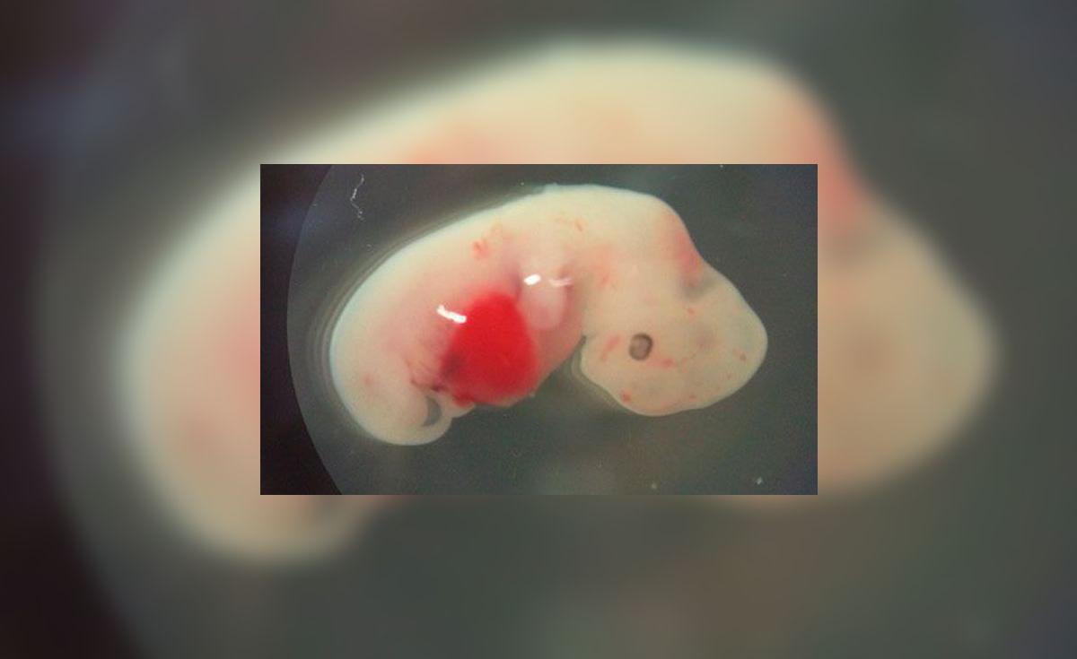 Científicos crearon el primer híbrido entre humano y cerdo | FOTOS ...