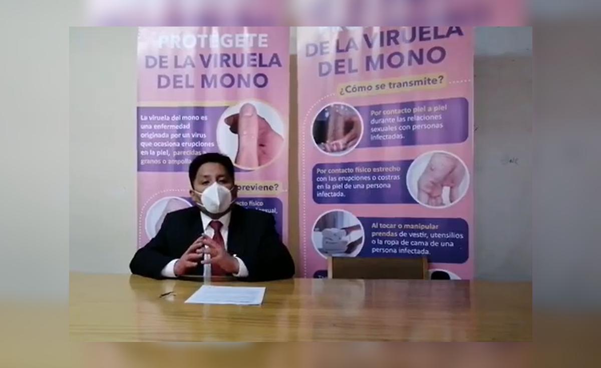 Viruela del mono: Diresa Puno informa sobre el primer caso en la región ...