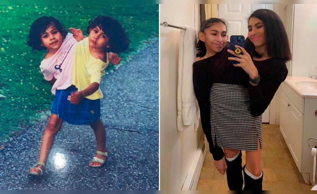 Así viven las hermanas siamesas que comparten pelvis y son sensación en ...