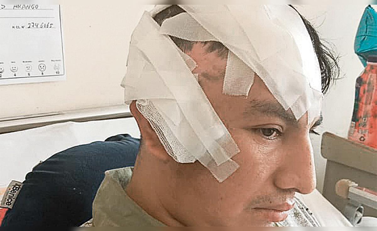 Rolando Marcas, el retrato de la represión policial | Dina Boluarte ...