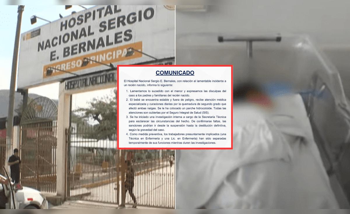 Comas | Hospital Sergio Bernales responde por bebé recién nacido que ...