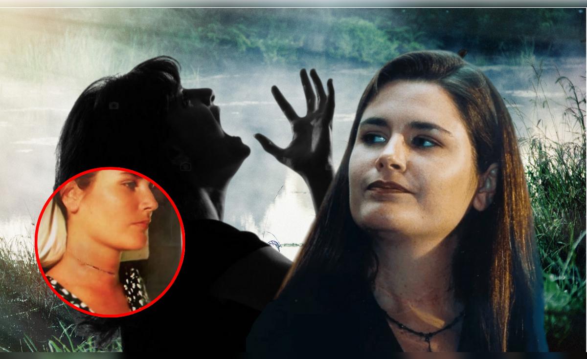 El insólito caso de Alison Botha, la mujer que se aferró a su cuerpo ...